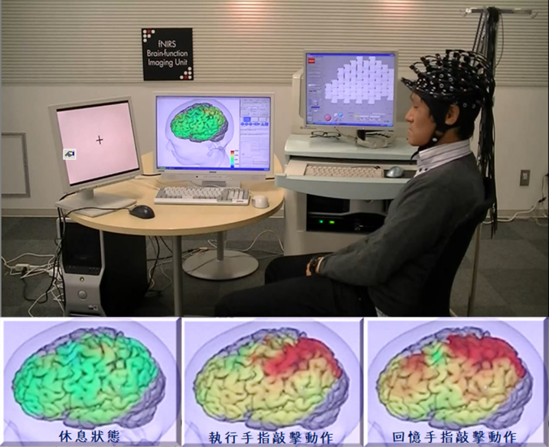 腦功能影像 Brain-Function Imaging : SHIMADZU (Shimadzu Corporation)